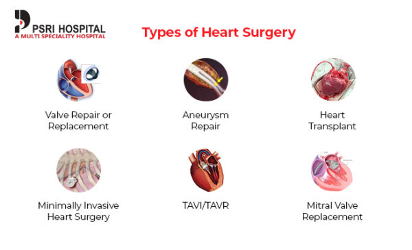 Know about Heart Surgery Types, Procedures, Recovery,&Risks
