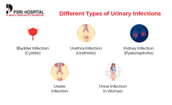 Everything You Need To Know About Urine Tract Infection