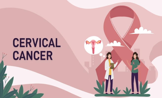 Cervical cancer - Symptoms & causes | PSRI Hospital