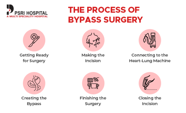 Understanding Bypass Surgery: Your Path to a Healthier Heart