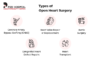Open Heart Surgery: Types, Procedure, Risks and Recovery