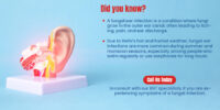 Fungal Ear Infections Causes Symptoms and Treatment