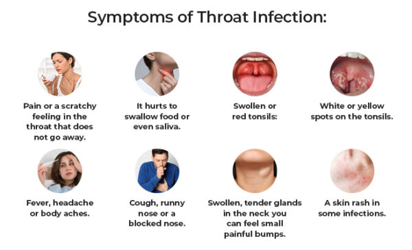Throat Infection: Causes, Symptoms and Treatment and Common Mistakes to ...